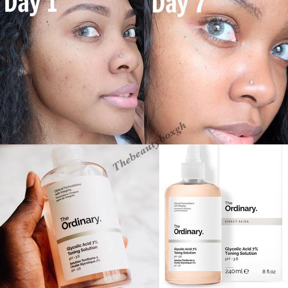 Review Toner Ordinary Glycolic Acid 7% Toning Solution - Giải pháp hiệu ...